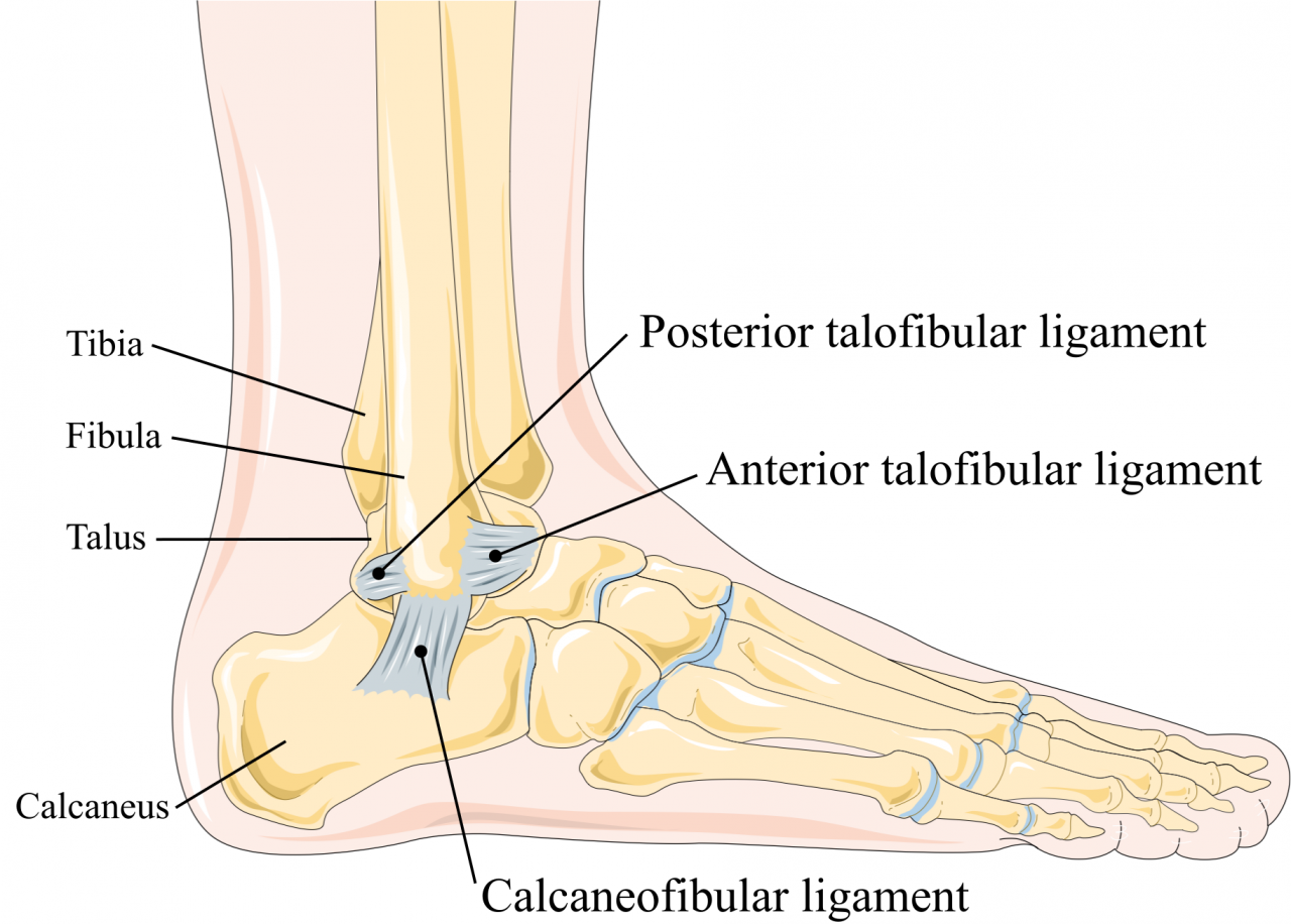 Retrocalcaneal Bursitis | Houston Shockwave Therapy